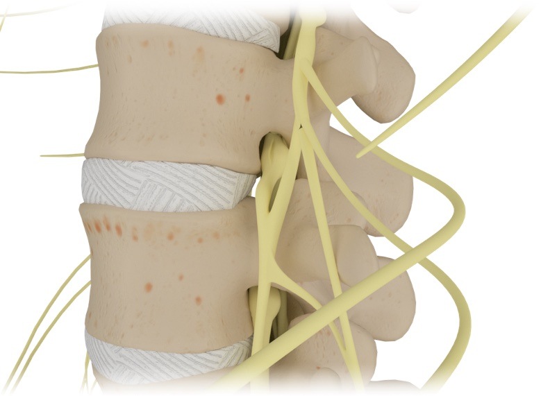 Lumbar Decompression | Benjamin Ditty M.D.