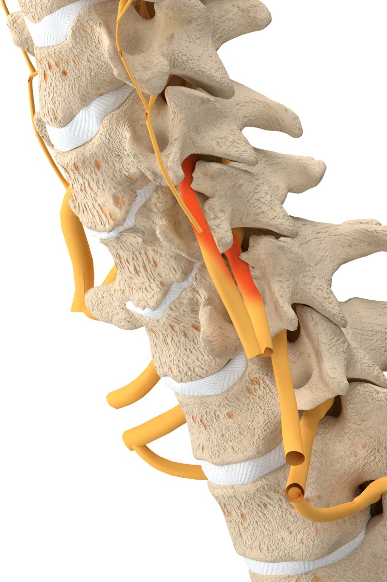 Nerve Compression | Benjamin Ditty M.D.